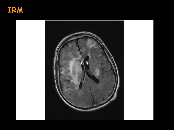 BRAIN STORMING Service de Ranimation Mdicale Polyvalente Centre