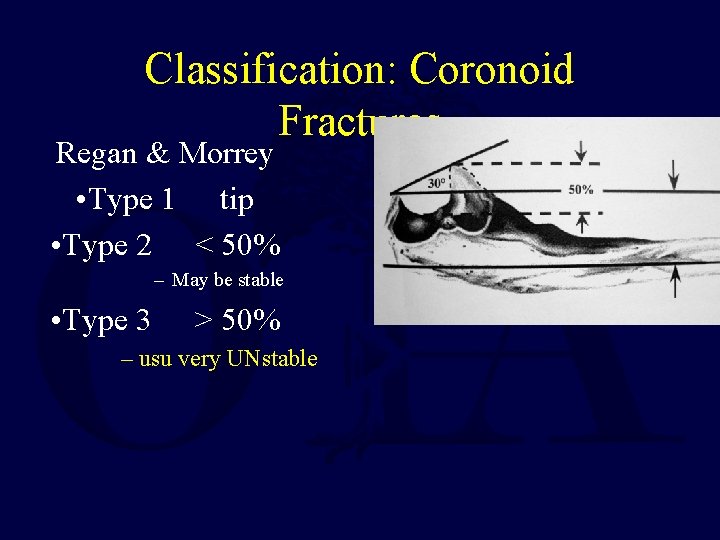Surgical Approaches for Terrible Triad FractureDislocations of the