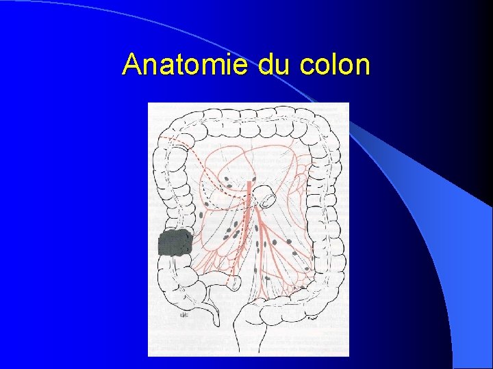 Pathologies chirurgicales du Colon et du Rectum Davide