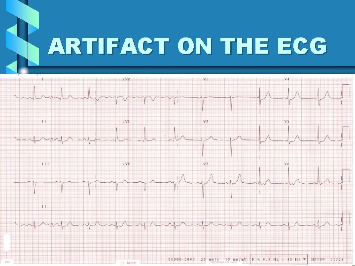 MAKING ECGS EASY APPLICATION FOR THE ECG EVALUATING