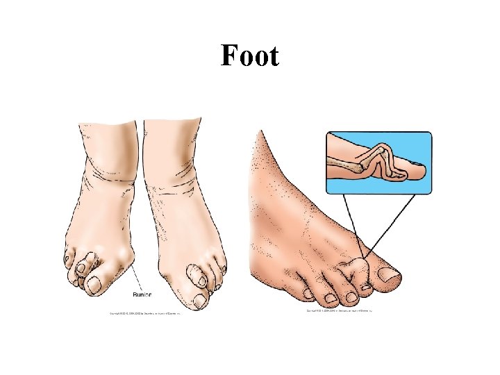 ALTERATIONS IN MOBILITY Assessment of the Musculoskeletal System