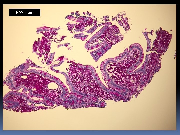 Bart Kenney MD Middlesex Hospital DIARRHEA AND ABDOMINAL