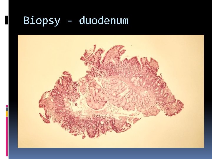 Bart Kenney MD Middlesex Hospital DIARRHEA AND ABDOMINAL