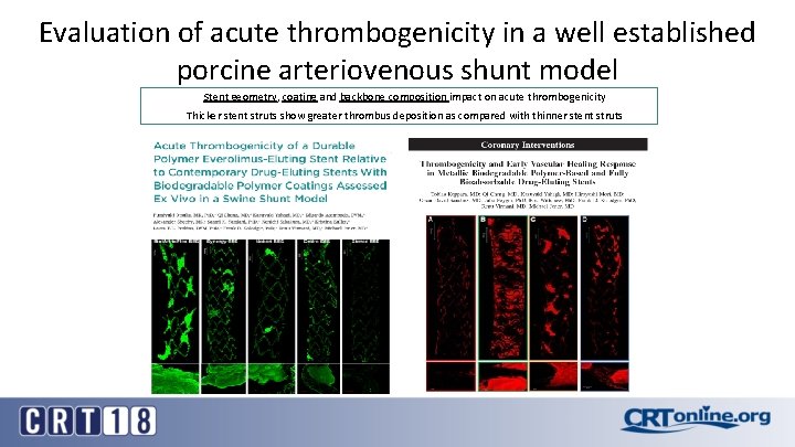 Magmaris Review of the Technology and its Clinical