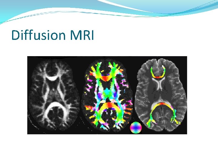 Magnetic Resonance Imaging MRI Steven Mc Lellan What