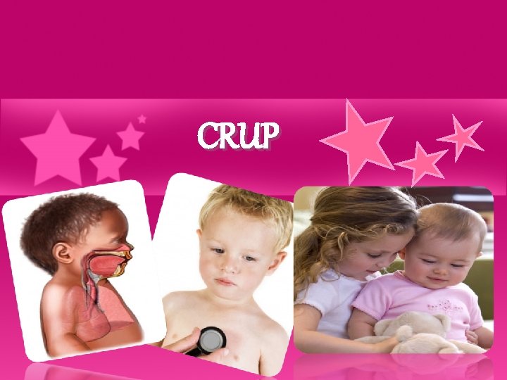 CRUP Consideraciones generales Usualmente de origen viral Causa