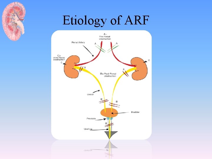 Approach to Acute renal failure Dr Mohammed AlGhonaim