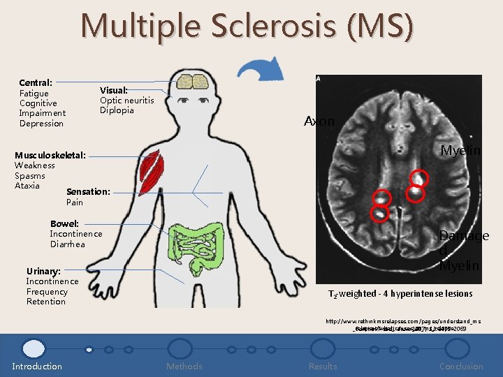 Corticospinal tract integrity measured using magnetic resonance imaging