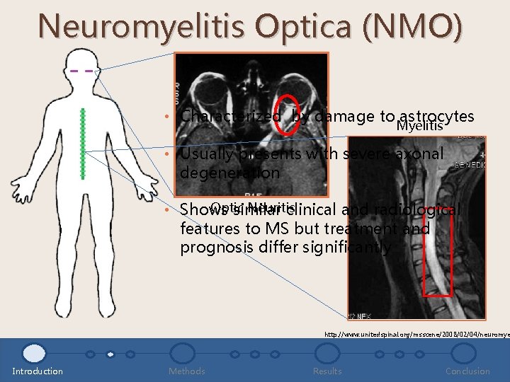 Corticospinal tract integrity measured using magnetic resonance imaging