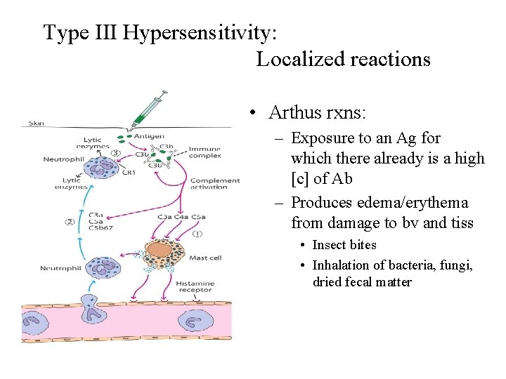 Type II Hypersensitivity Antibodymediated cytotoxicity Results when Ig