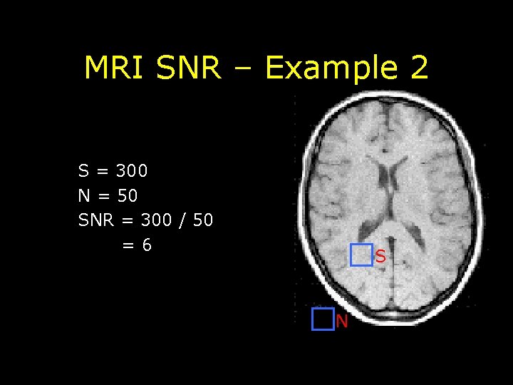 Signal and Noise in f MRI John Van