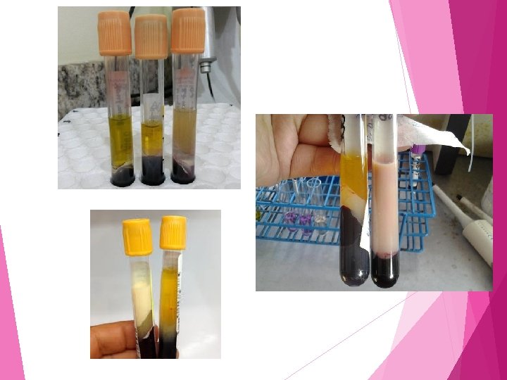 MODULO AYUDAS DIAGNOSTICAS LABORATORIO CLINICO DOCENTE ADRIANA TORRES