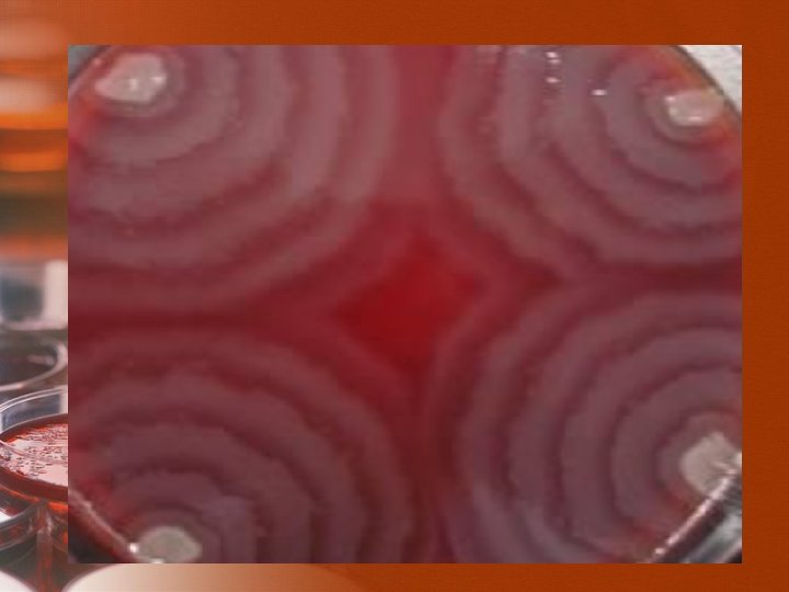 Proteus Morganella Providencia species Dr Baha Eldin Khalid