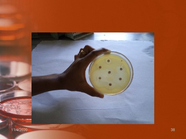 Proteus Morganella Providencia species Dr Baha Eldin Khalid