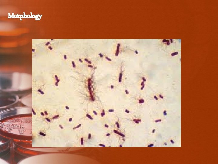 Proteus Morganella Providencia species Dr Baha Eldin Khalid