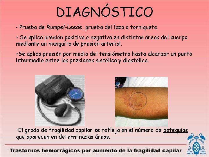 TRASTORNOS HEMORRGICOS POR AUMENTO DE LA FRAGILIDAD CAPILAR