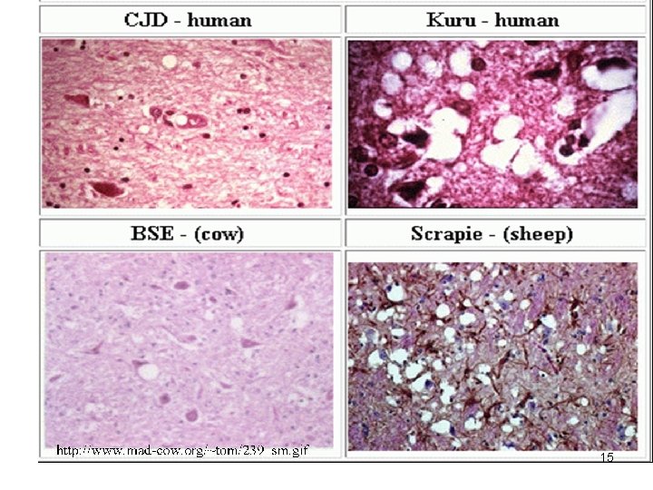 Transmissible Spongiform Encephalopathies 1 Kuru Since the early
