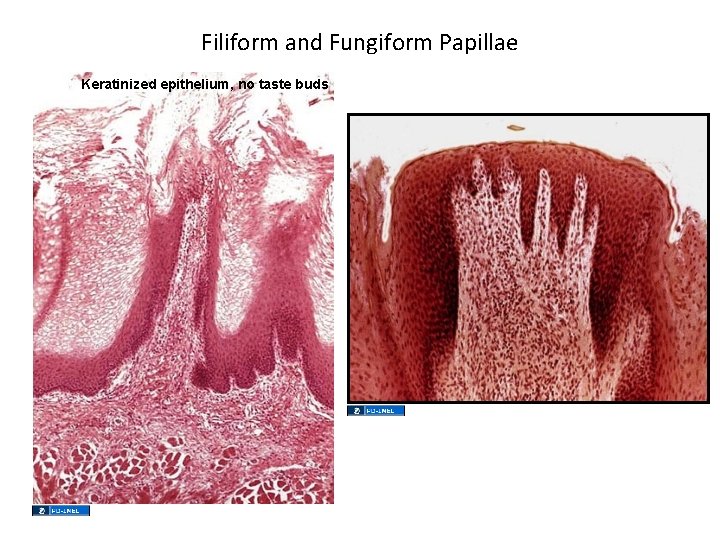 Oral mucosa The surface of oral cavity is