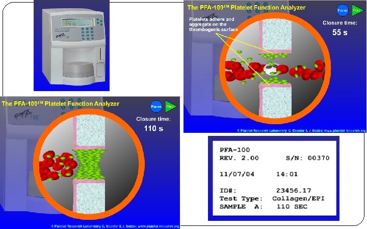 General Approach in Investigation of Haemostasis Platelets aggregation