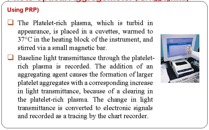 General Approach in Investigation of Haemostasis Platelets aggregation