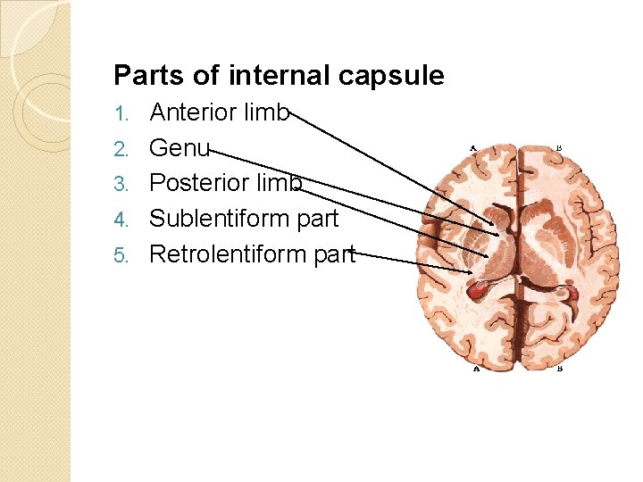 WHITE MATTER OF CEREBRUM White matter is a