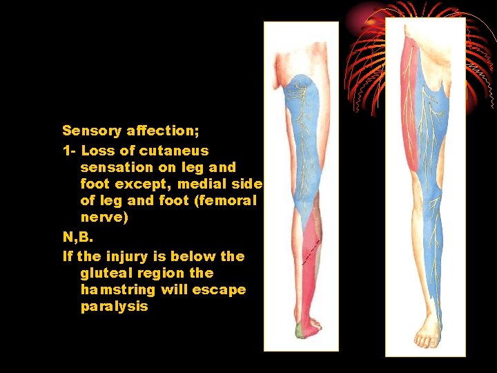 NERVE INJURYS OF LOWER LIMB BY Essam Eldin