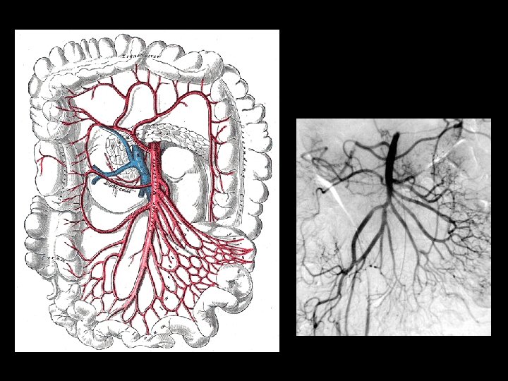 VASCULARISATION DU TUBE DIGESTIF PCEM 2 2011 Olivier
