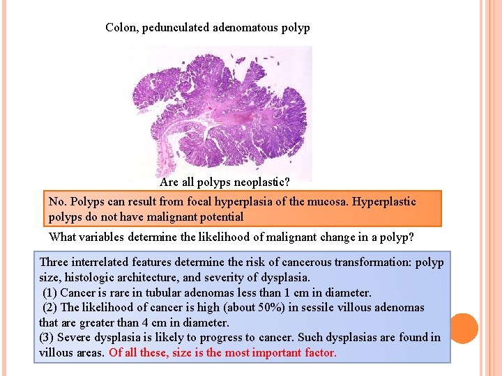 GASTROINTESTINAL BLOCK PATHOLOGY LECTURE 2015 Benign Tumors of