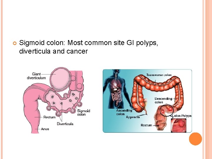 GASTROINTESTINAL BLOCK PATHOLOGY LECTURE 2015 Benign Tumors of