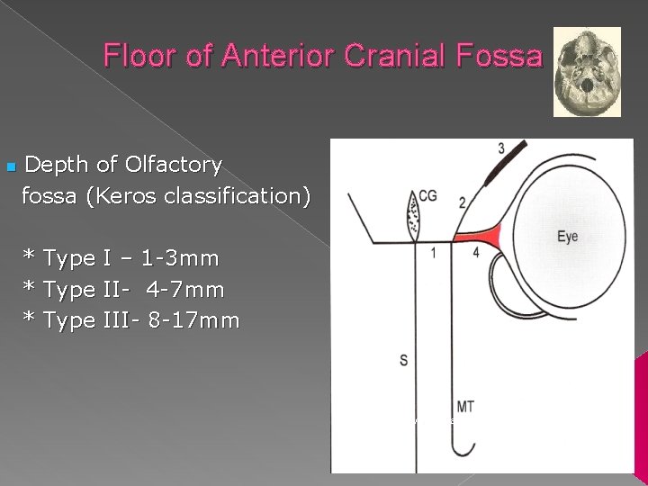 Surgical Anatomy of Skull Base Dr Supreet Singh