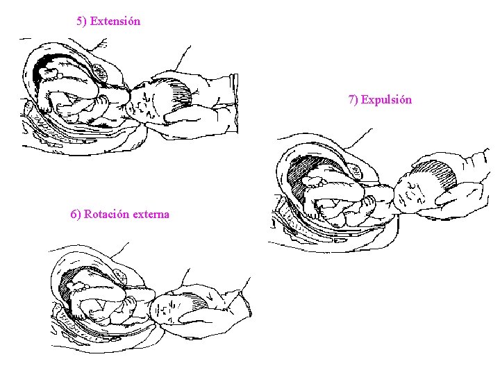ATENCION DE PARTO NORMAL Dr Mauricio a Lpez