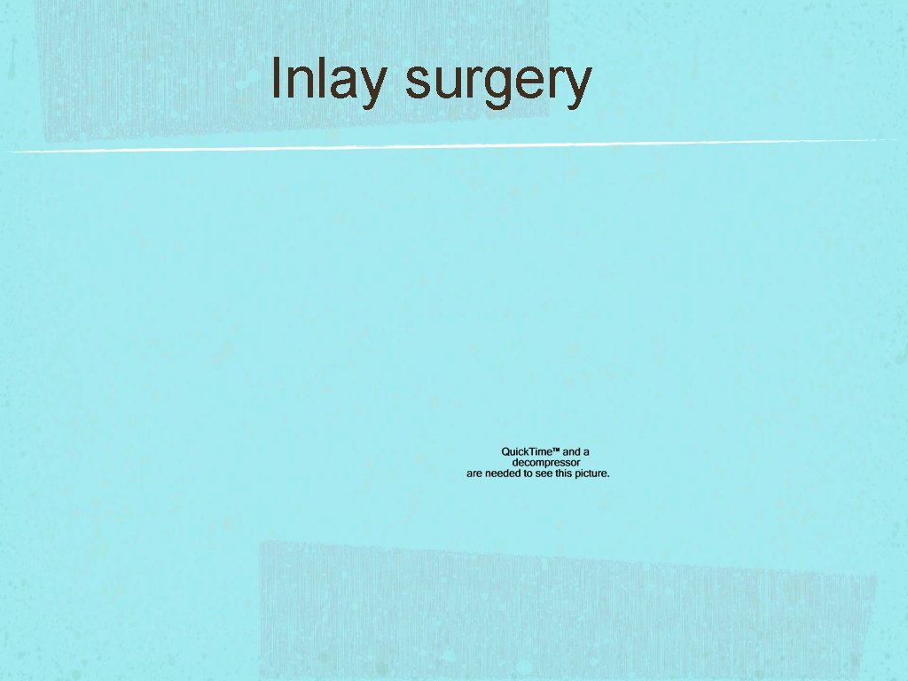 New Treatments for Presbyopia Erin D Dunphy O