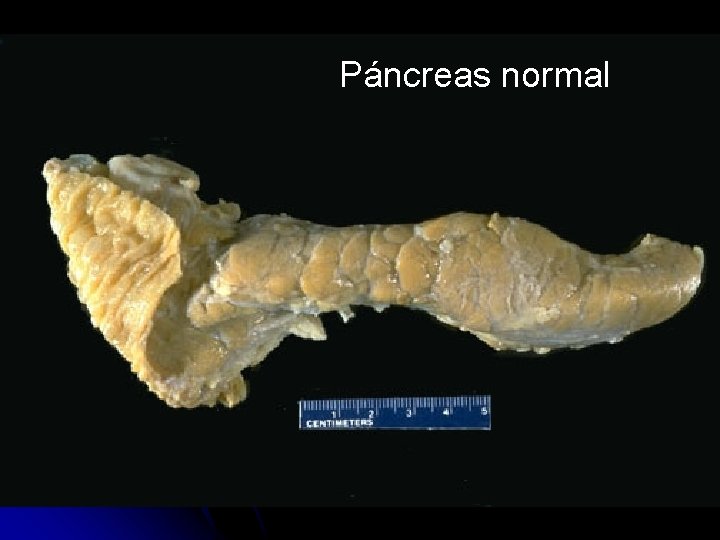 TANATOLOGA FORENSE TANATOLOGA FORENSE CAMBIOS POSTMORTEM INMEDIATOS v