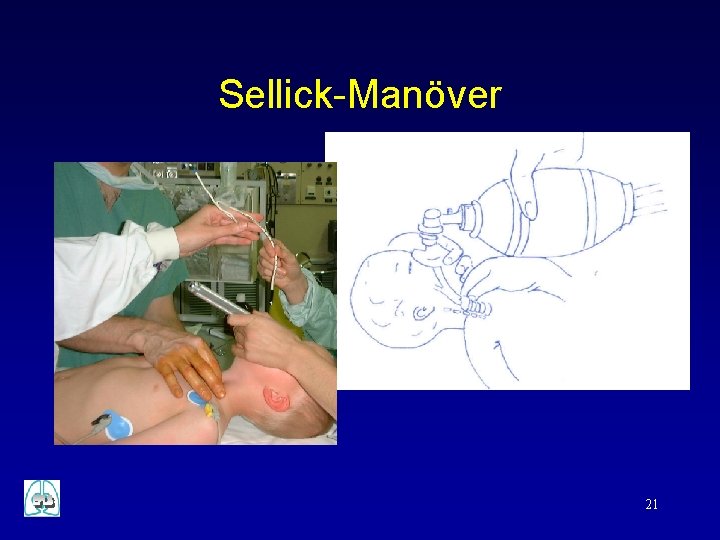 European Resuscitation Council Anatomische Besonderheiten 2 u u
