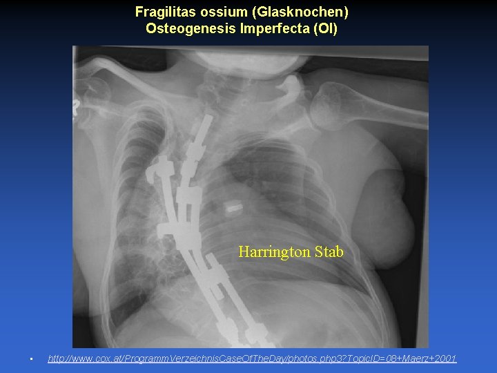 Radiologie des Skelett Systems Teil 2 M Harth