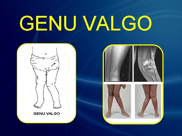 UNIVERSIDAD MICHOACANA DE SAN NICOLAS DE HIDALGO FACULTAD