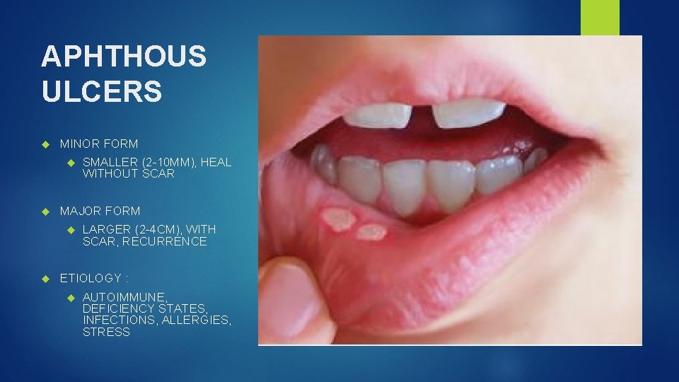 COMMON DISORDERS OF THE ORAL CAVITY DR SUBHODH