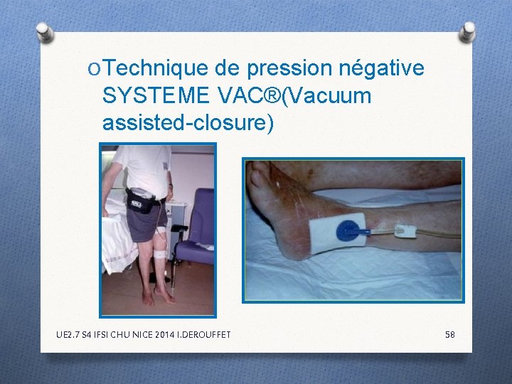 PLAIES PANSEMENTS ET CICATRISATION UE 2 7 S