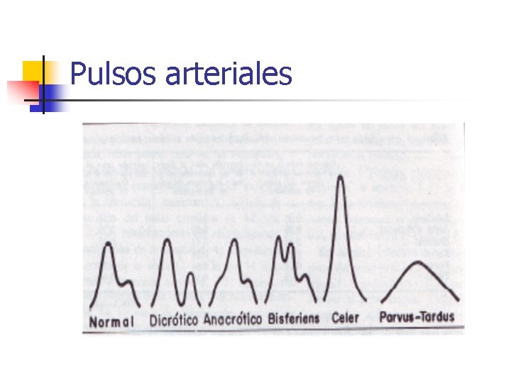 Pulsos arteriales y venosos Dr Jorge Arauz Ch