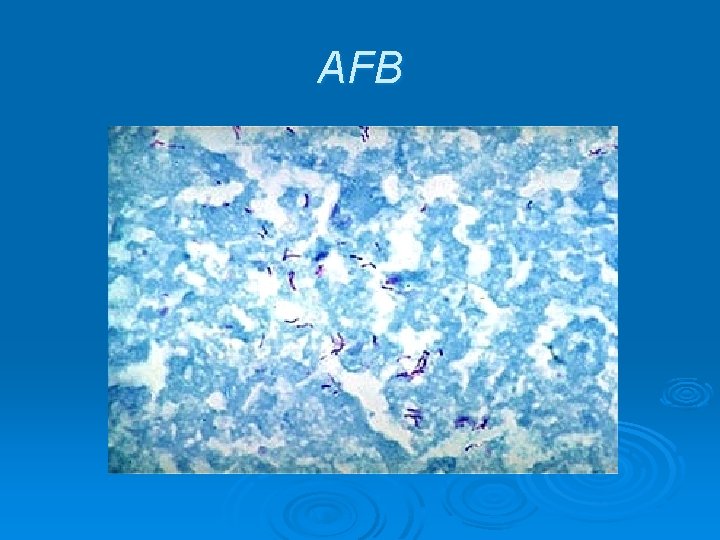 MYCOBACTERIUM TUBERCULOSIS Introduction Chronic granulomatous ...