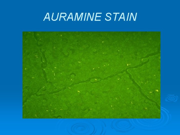 MYCOBACTERIUM TUBERCULOSIS Introduction Chronic granulomatous ...