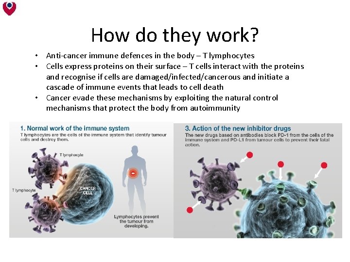 Immunotherapy and Cancer New treatments and new challenges