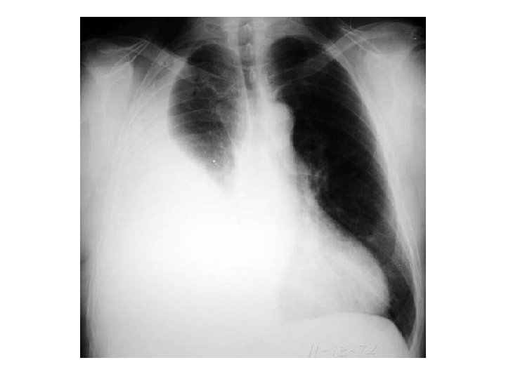 Review of Common Radiographs Pneumoperitoneum Air under the
