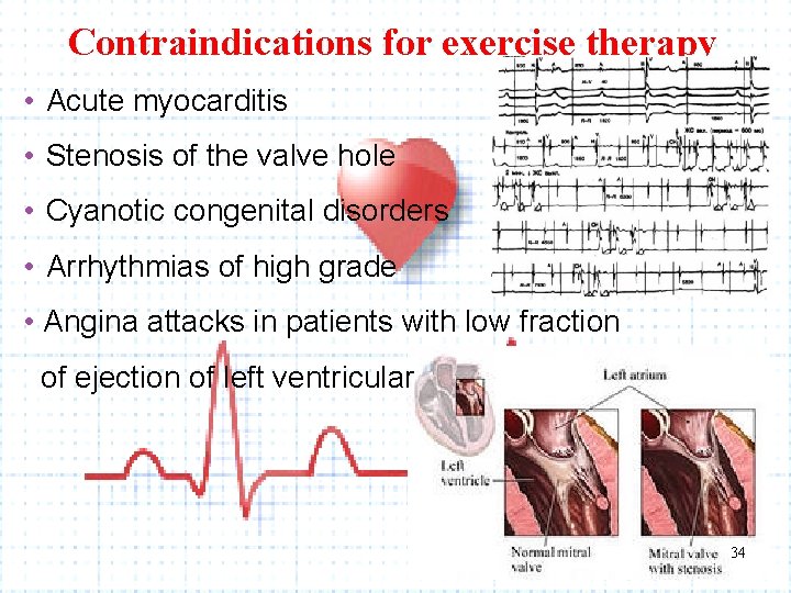 Rehabilitation in case of the diseases of cardiovascular