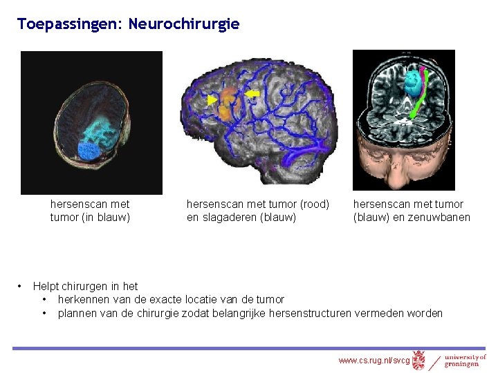 Medische Datavisualisatie Van 3 D scans naar beelden