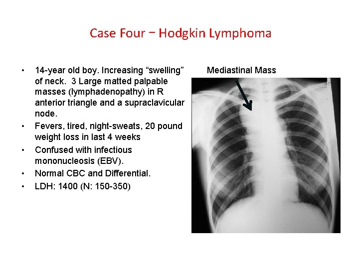 Red Flags in the Diagnosis of Pediatric Cancer