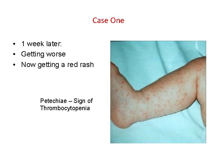 Red Flags in the Diagnosis of Pediatric Cancer