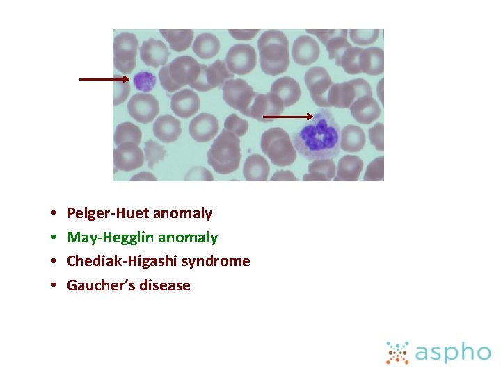 Disorders of Leukocytes Header Carl Allen MD Ph