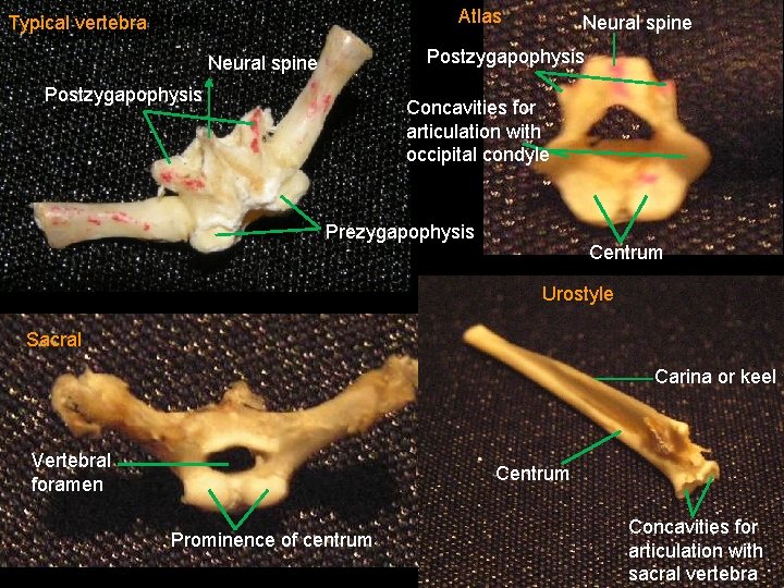 Skeletal system Lower jaw The vertebrae Pelvic Girdle