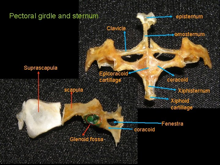 Skeletal system Lower jaw The vertebrae Pelvic Girdle
